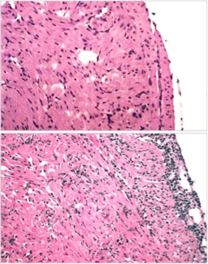 About HSMI and CMS | BioMar
