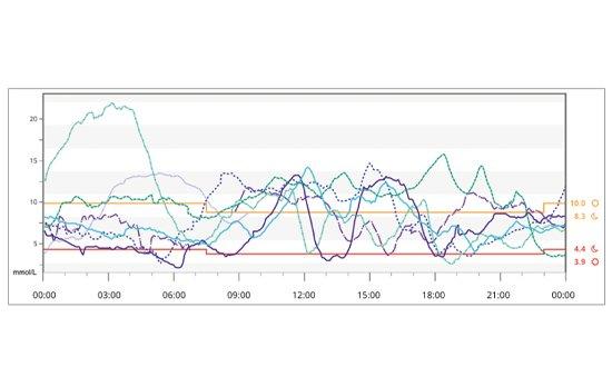 Dexcom Clarity | Dexcom