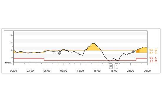 Dexcom Clarity | Dexcom