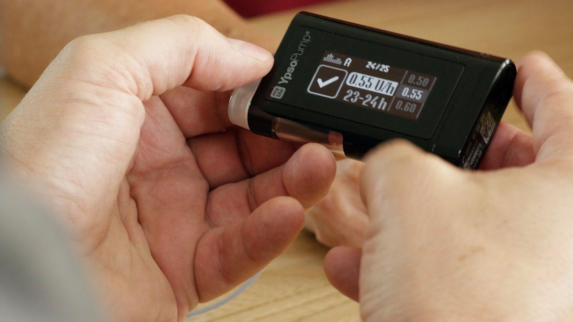 Dexcom CGM systems and the mylife YpsoPump | Dexcom