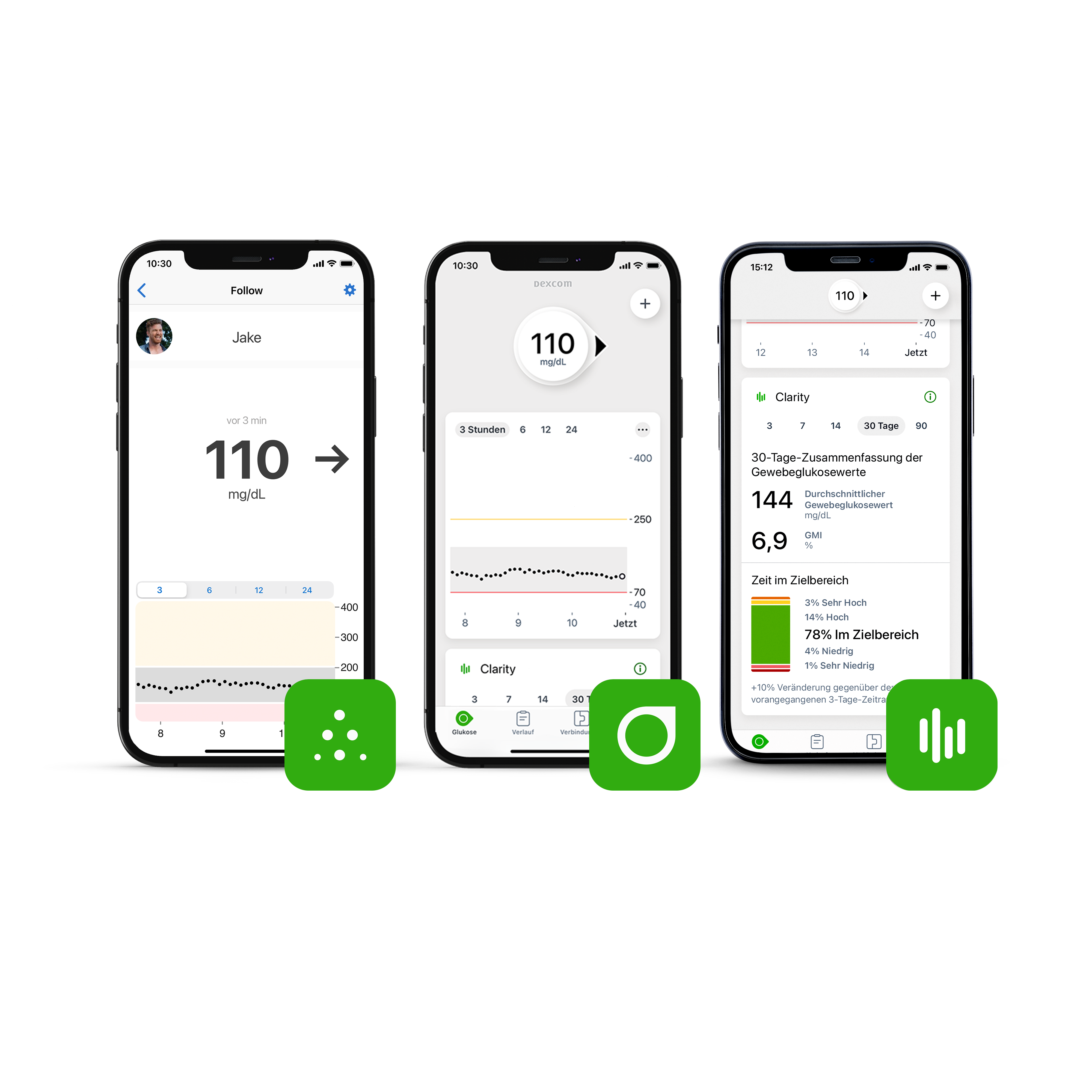 Dexcom G7 CGM System | Dexcom