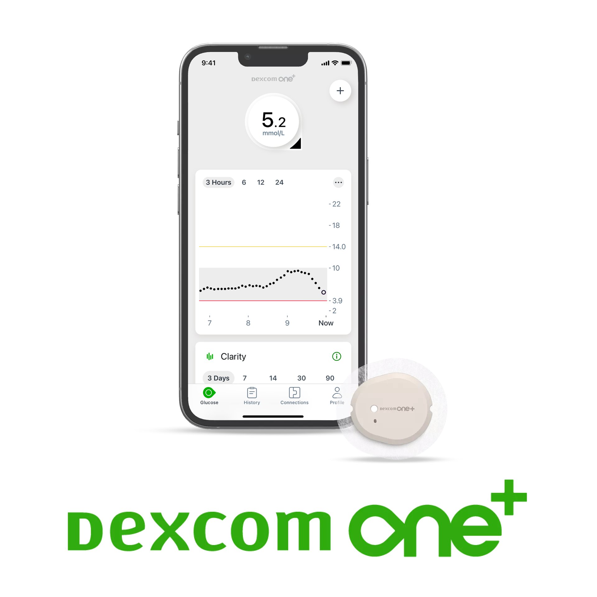 Type 2 Diabetes | Dexcom