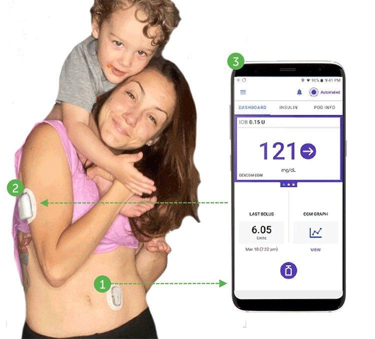 Get Started with Dexcom CGM | Dexcom