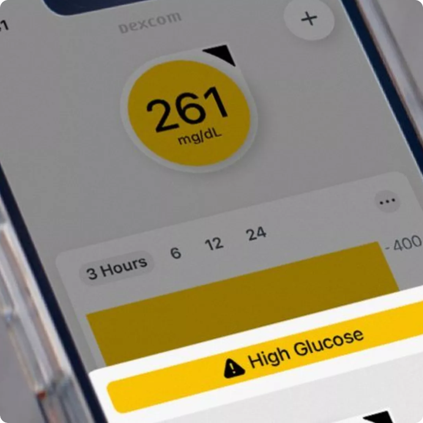 Get Started with Dexcom CGM | Dexcom