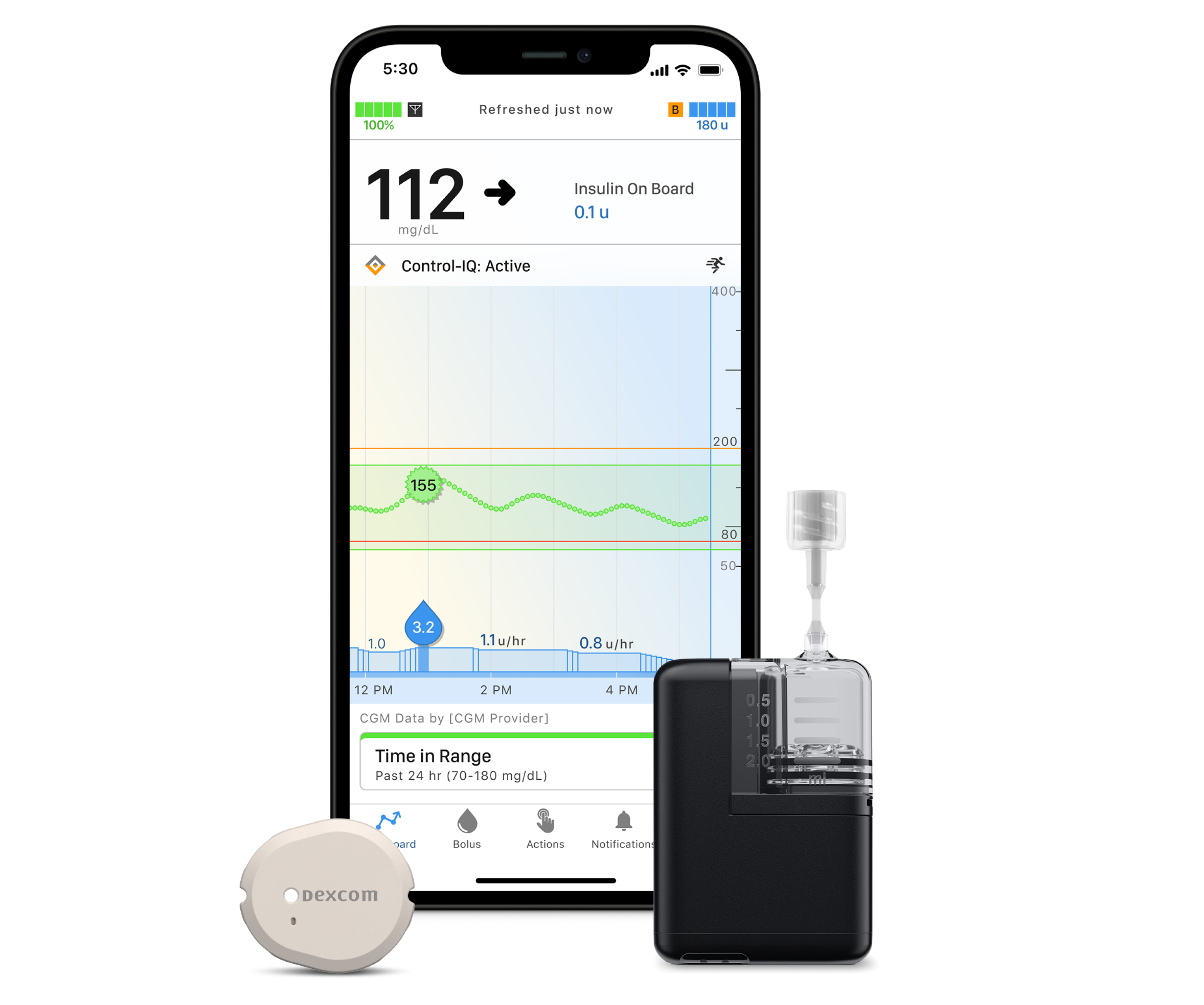 Dexcom Continuous Glucose Monitoring | Dexcom