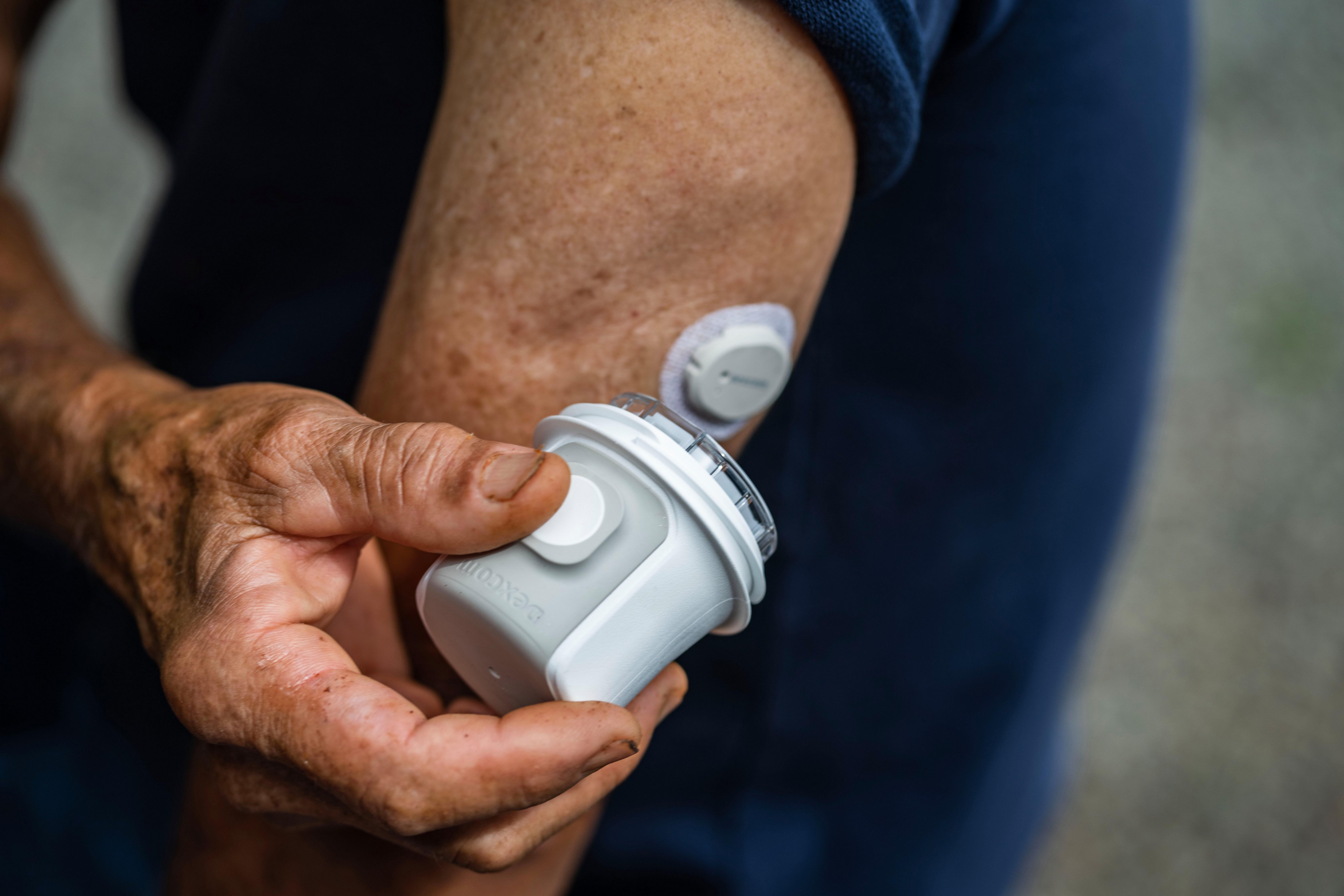 Dexcom ONE+ Receiver | Dexcom