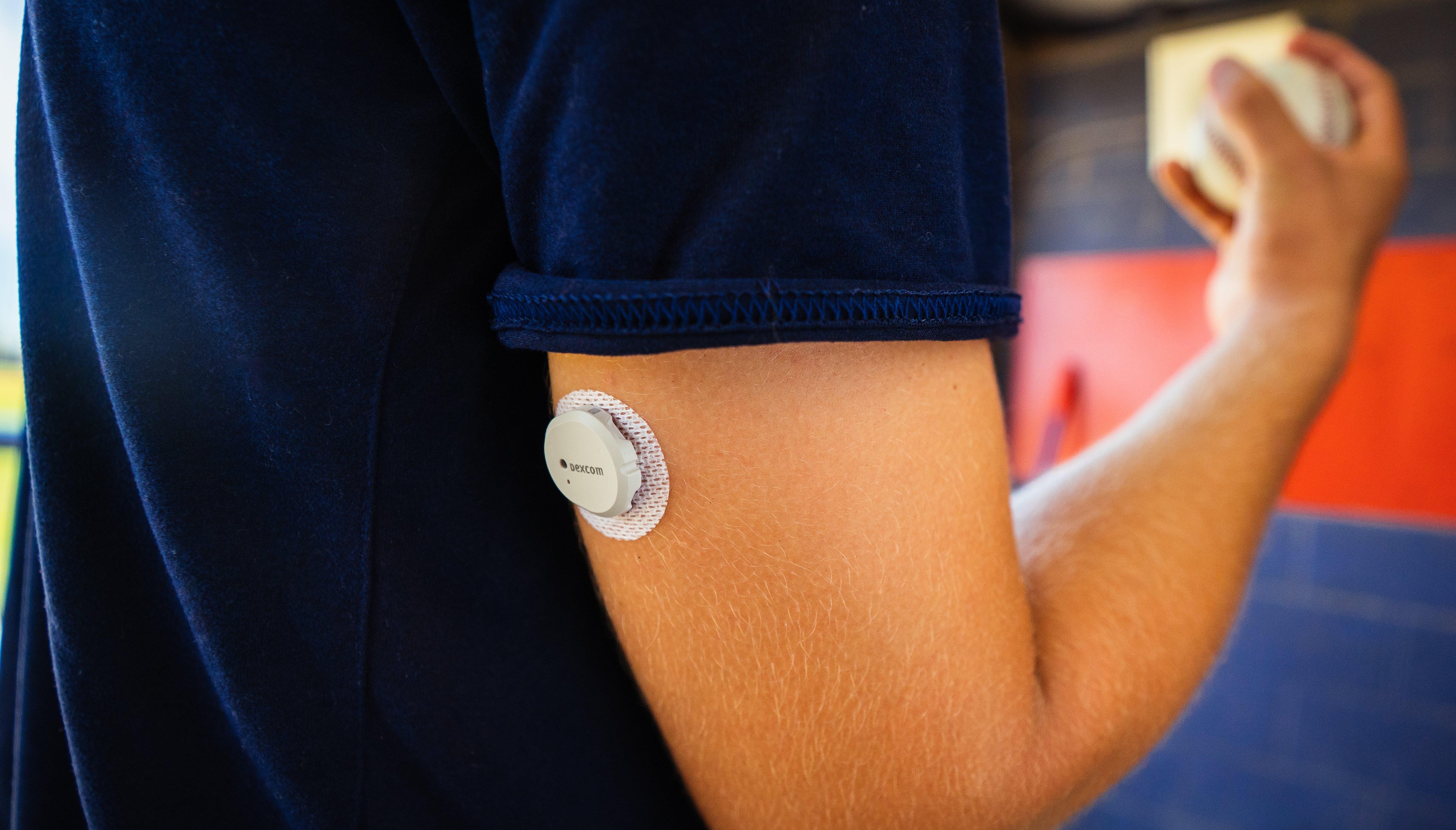 What is a CGM (Continuous Glucose Monitoring) Device? | Dexcom