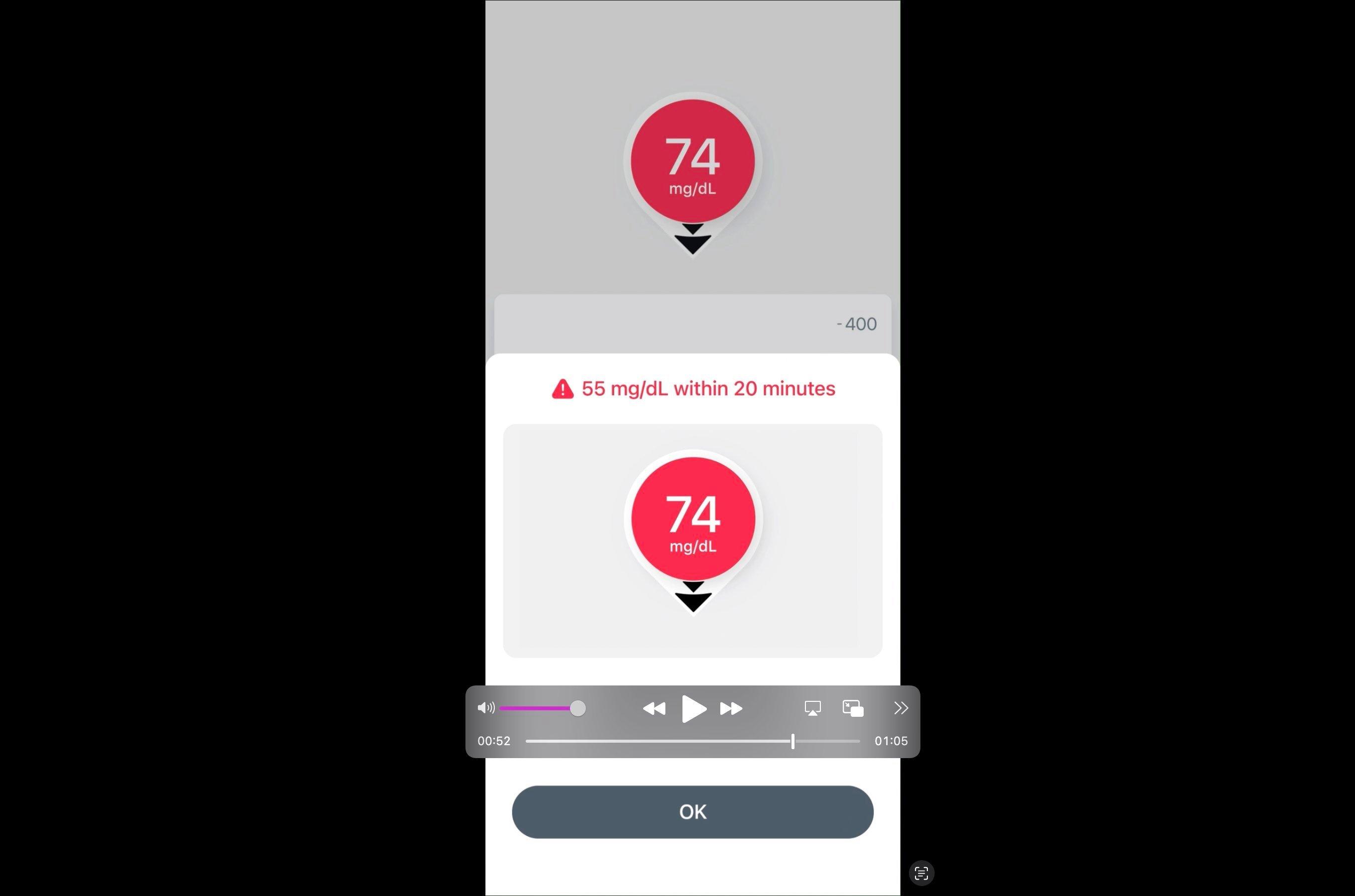 El nuevo sensor de glucosa Dexcom G7 | Dexcom
