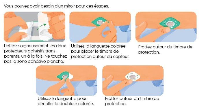 À quel endroit puis-je insérer mon capteur Dexcom G7? | Dexcom À quel endroit puis-je insérer mon capteur Dexcom G7? | Dexcom