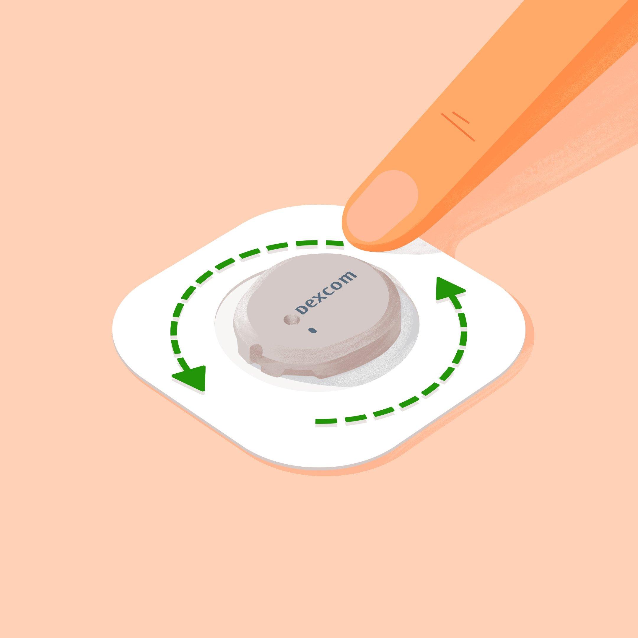 Diabetes Skin Care and Patch Adhesion | Dexcom | Dexcom