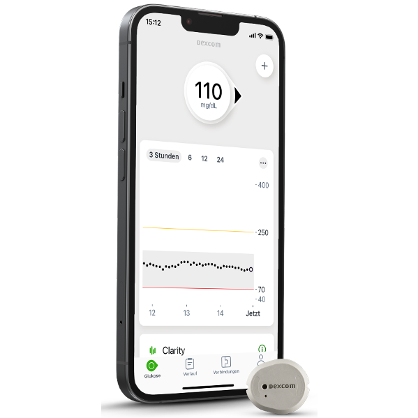 Welches Dexcom CGM-System ist das Beste für Sie? | Dexcom