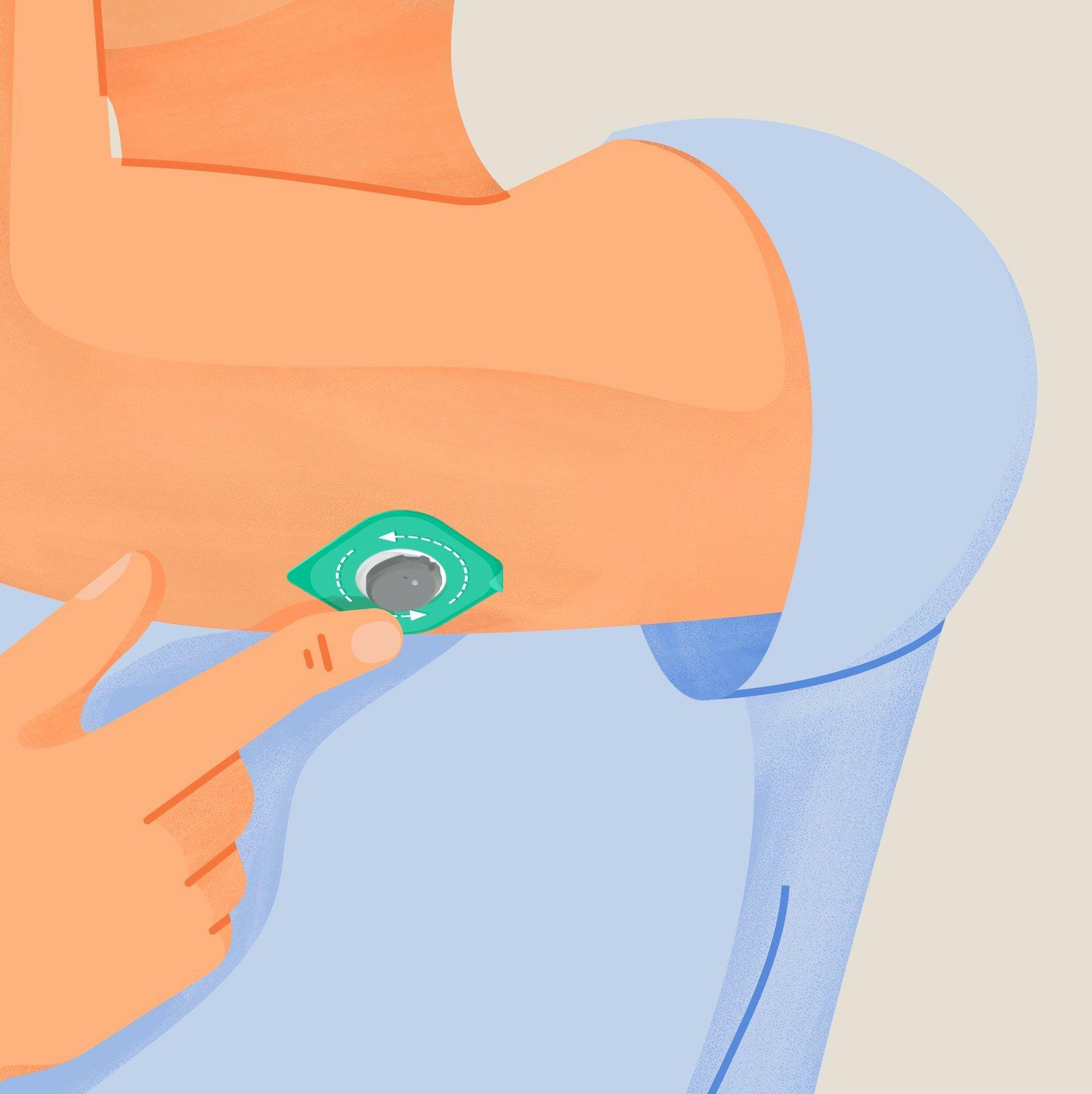 Get Started with Stelo Glucose Biosensor System | Stelo by Dexcom