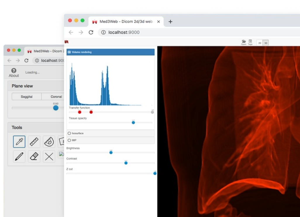 Product Spotlight: MRI Viewer - Online 3D Medical Image Viewer
