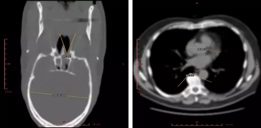 Product Spotlight: MRI Viewer - Online 3D Medical Image Viewer