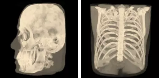 Product Spotlight: MRI Viewer - Online 3D Medical Image Viewer