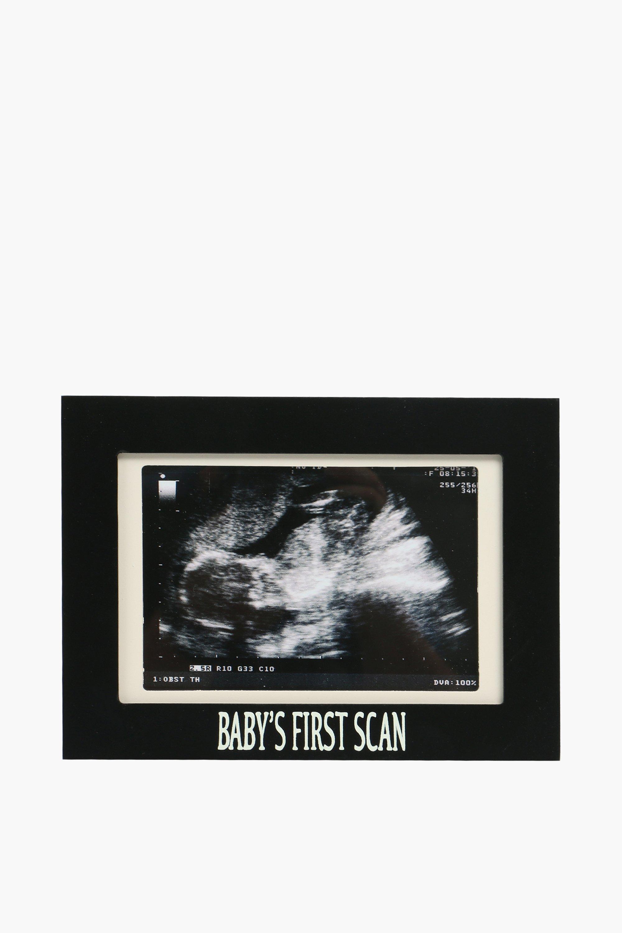 My First Scan Photo Frame